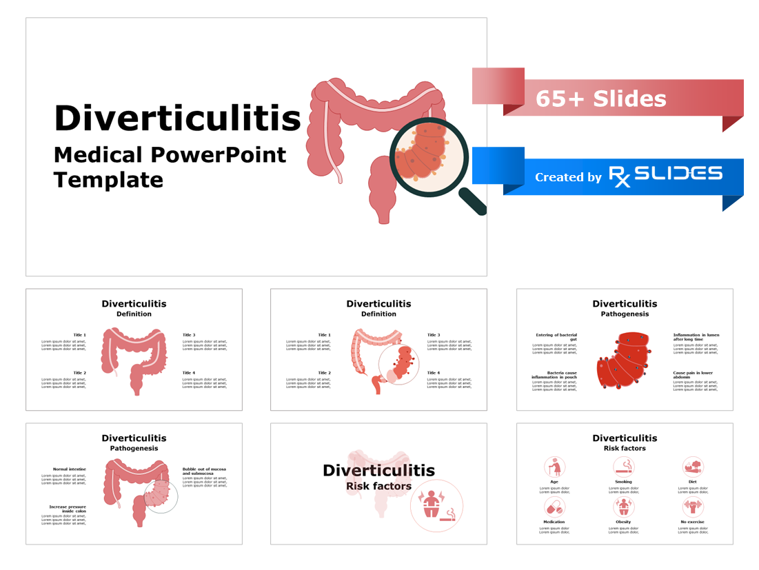 Download Diverticulitis PowerPoint Template|RxSlides
